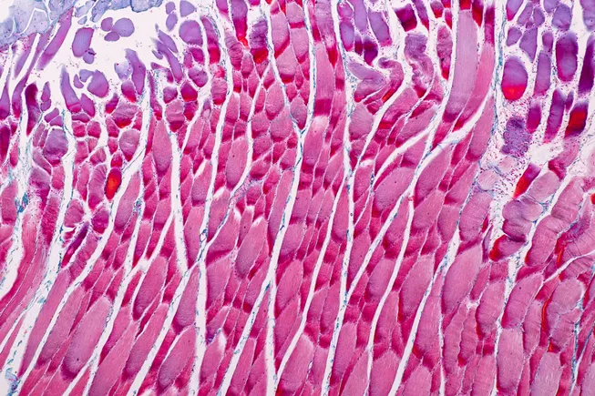 Muscle-building drug improves body composition in obesity trial, Veru ...