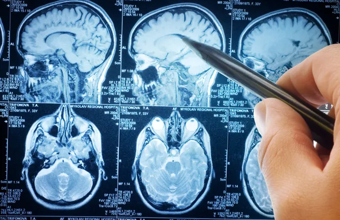 Precision medical imaging set for explosive growth, analysts say ...