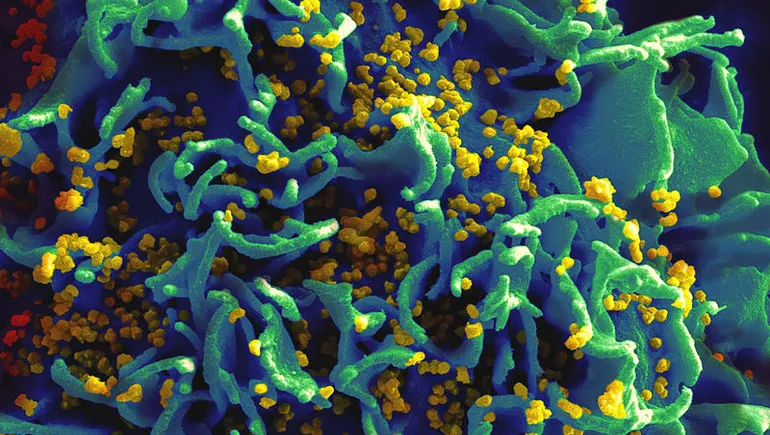 Merck advancing 2-drug HIV hopeful | BioPharma Dive