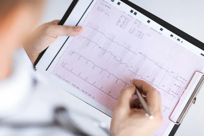 HIMSS14: New ECG can channel readings to EMR | Healthcare Dive