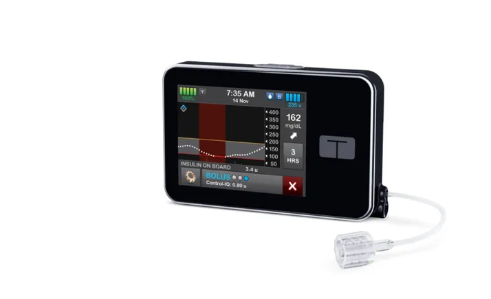 Tandem pump, paired with Dexcom CGM, boosts blood glucose control in ...
