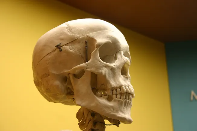 FDA panel recommends NPS Pharma's orphan drug Naptara | BioPharma Dive