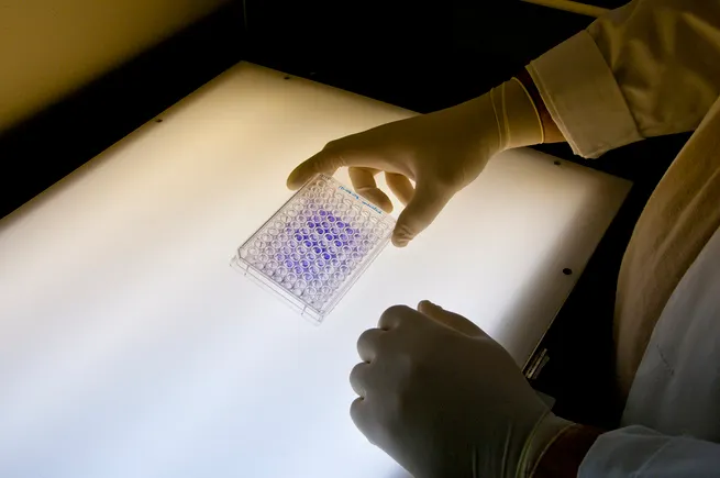 Kite, Juno ramping up commercial manufacturing capacity for CAR-T ...