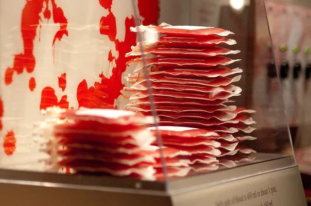 Historic: FDA approves first-ever system to cut blood transfusion ...