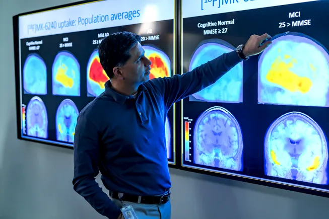 Biogen, aiming for a better Alzheimer’s therapy, licenses a Denali ...