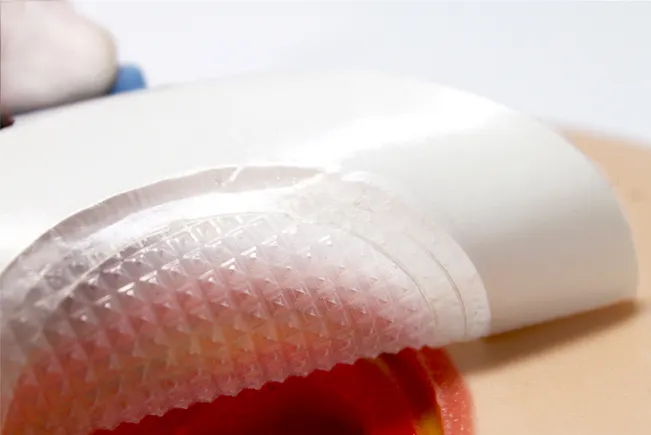 Wound therapy device wins FDA authorization | MedTech Dive