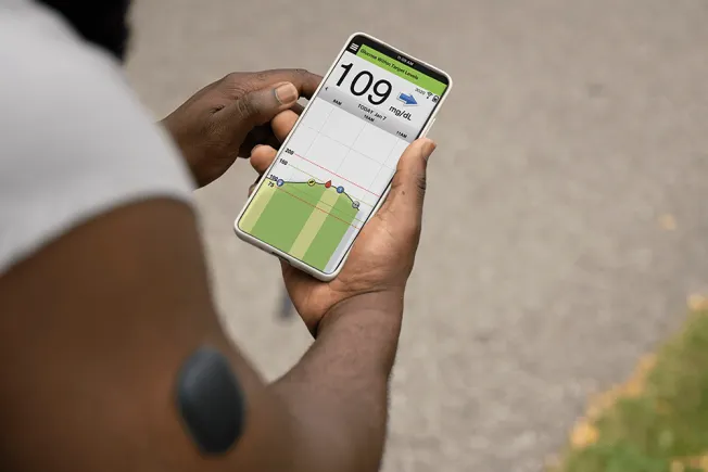 Senseonics tips 365-day CGM to double 2025 sales | MedTech Dive