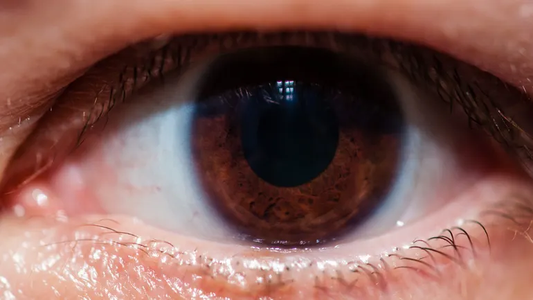 Adverse events prompt FDA to advise monitoring of Alcon implants ...